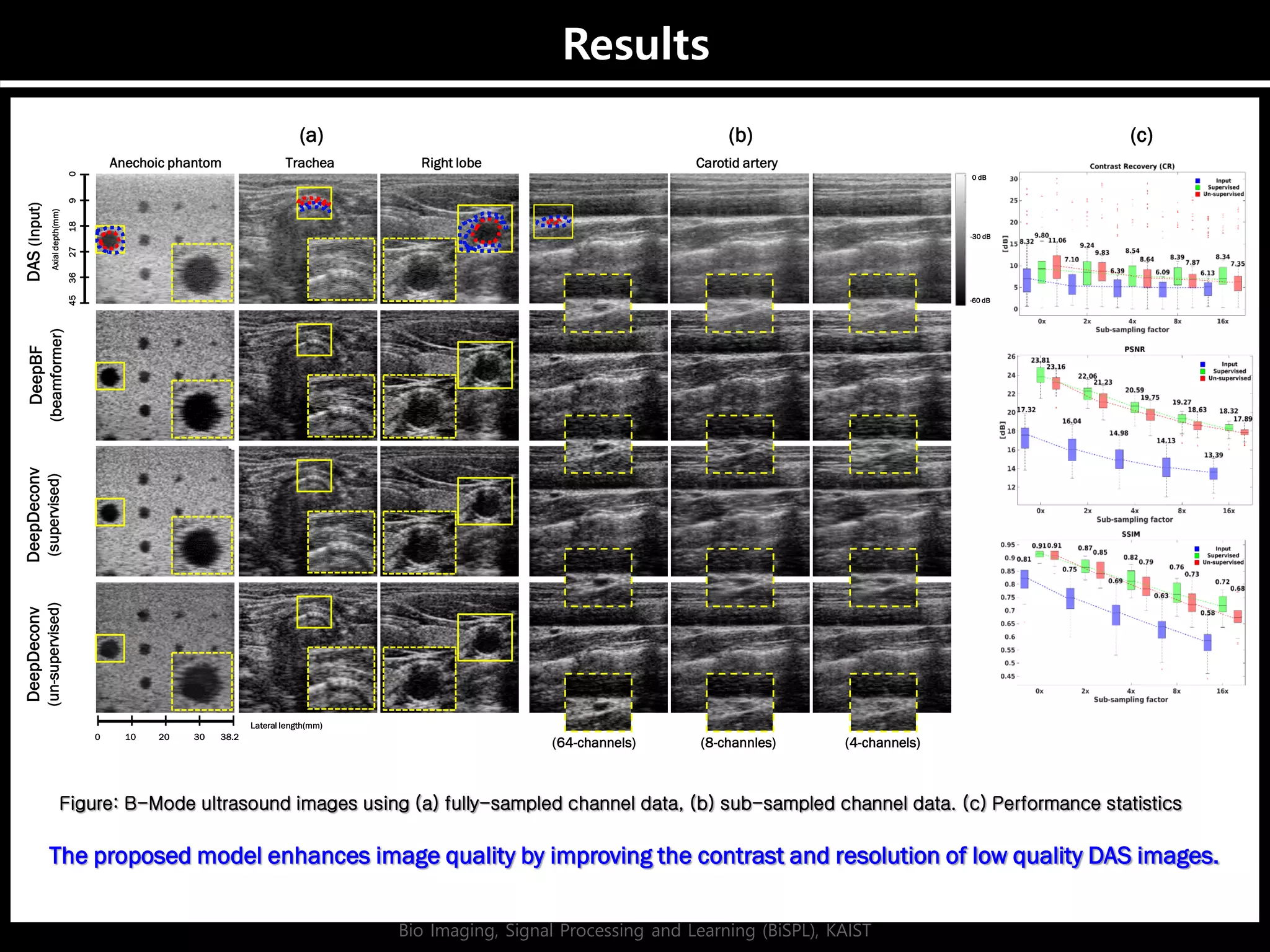 Unsupervised Deconvolution Neural Network For High Quality Ultrasound