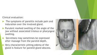 Deep facial spaces of head and neck | PPTX