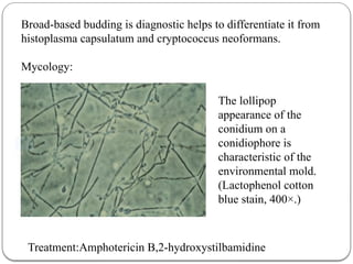 DEEP FUNGAL INFECTIONS-Candida, Aspergillus | PPTX