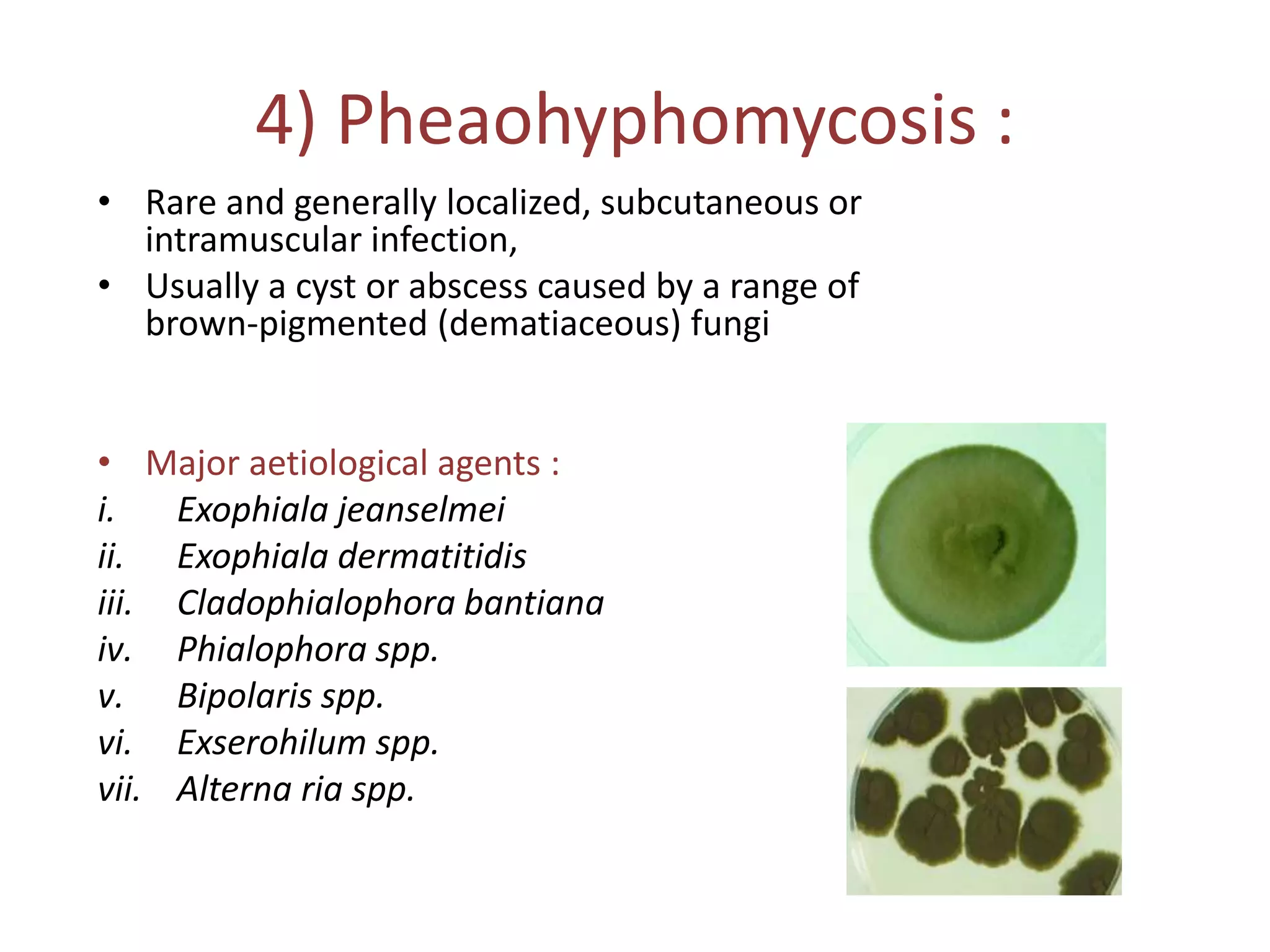 DEEP FUNGAL MYCOSIS_100307.pptx