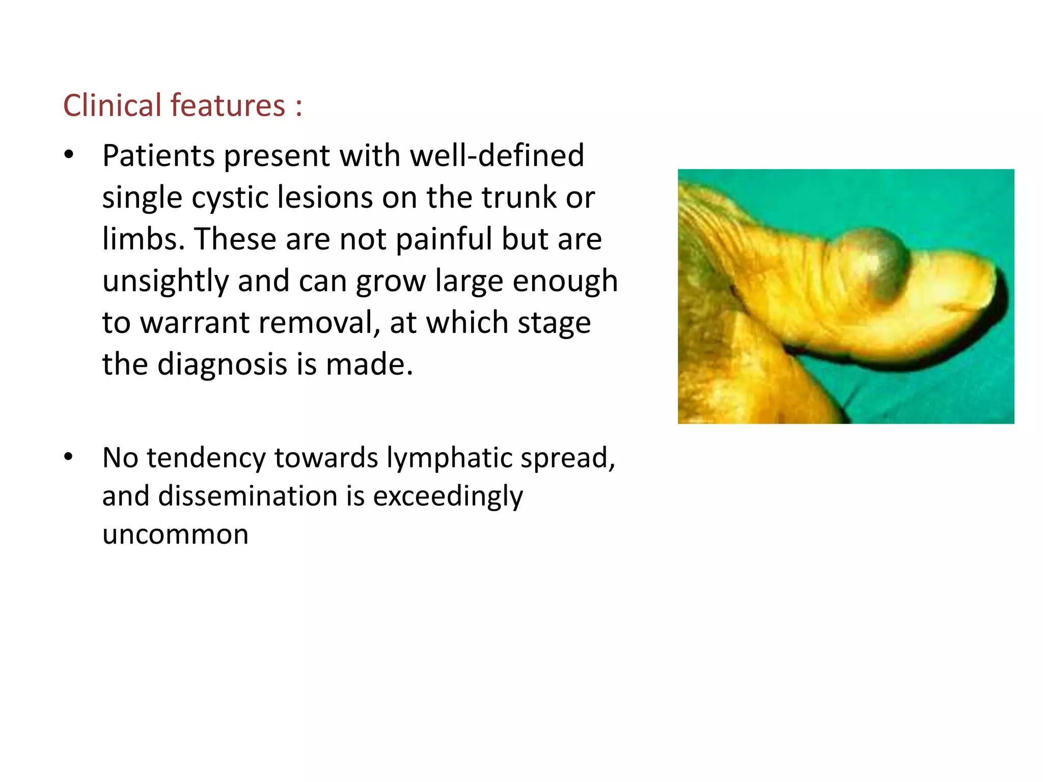 DEEP FUNGAL MYCOSIS_100307.pptx