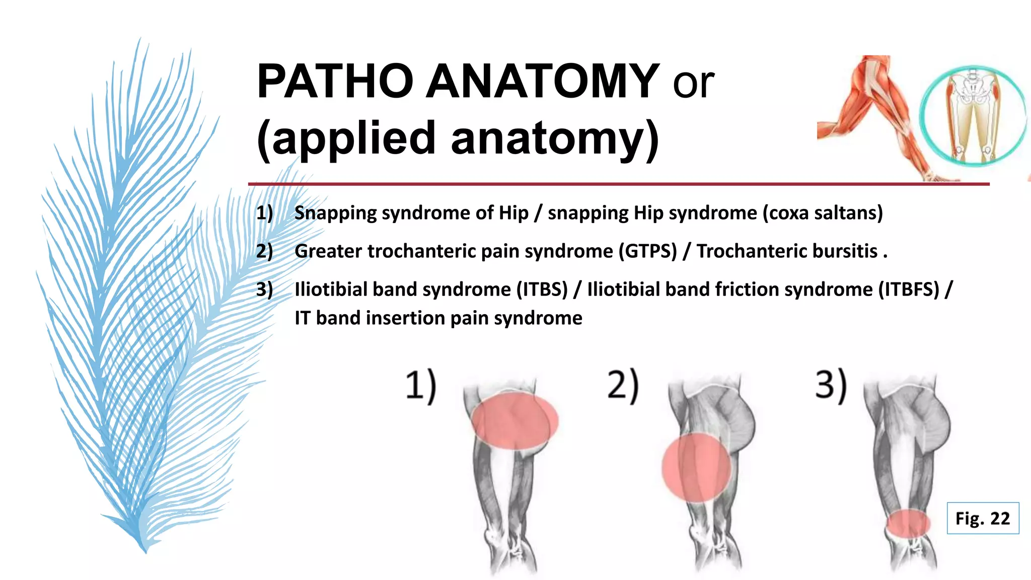 Deep layer of (Iliotibial) IT band | PPTX