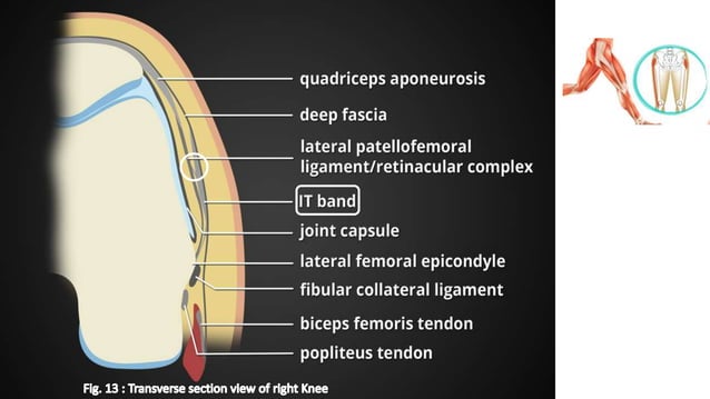 Deep layer of (Iliotibial) IT band | PPTX