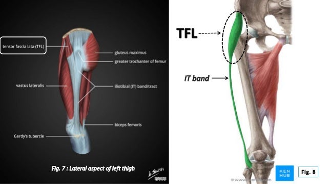 Deep layer of (Iliotibial) IT band