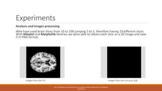Deep Learning aplicado al diagnostico de Alzheimer | BioInformaticsGRX | PPT