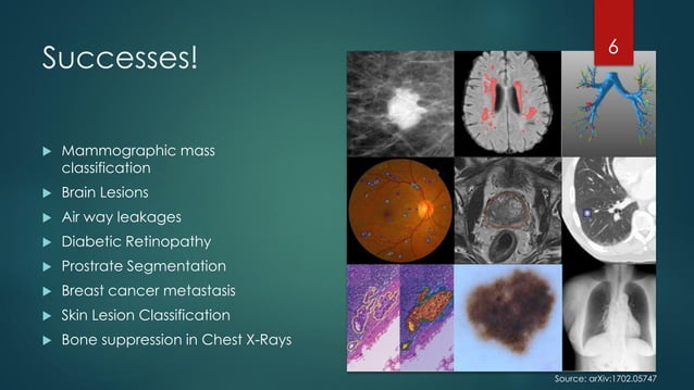 Deep learning for medical imaging