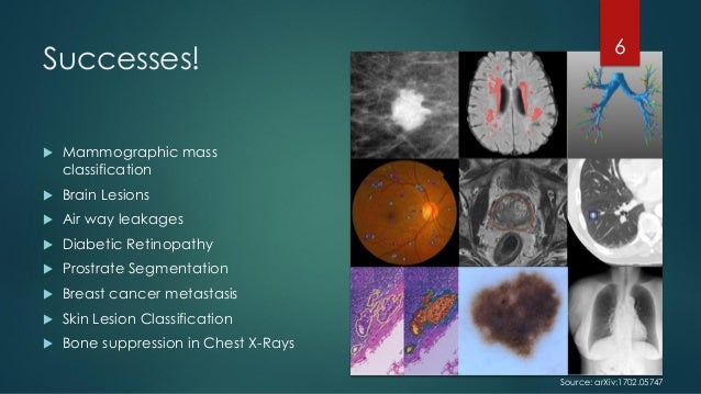 Deep learning for medical imaging