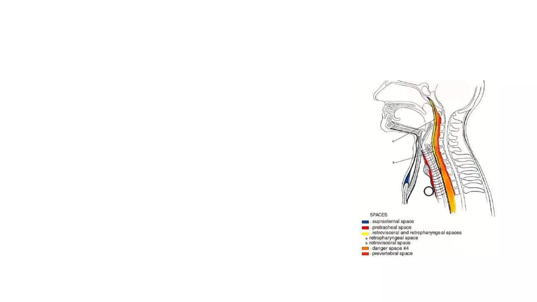 Deep neck space infection ENT REVISION NOTES | PPTX
