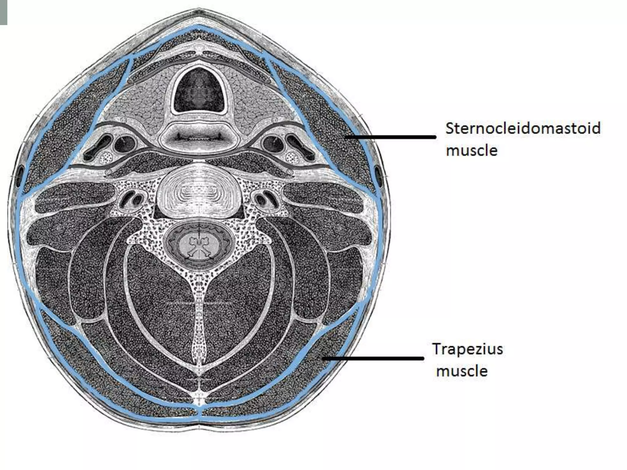 Deep neck spaces and surgical anatomy | PPTX