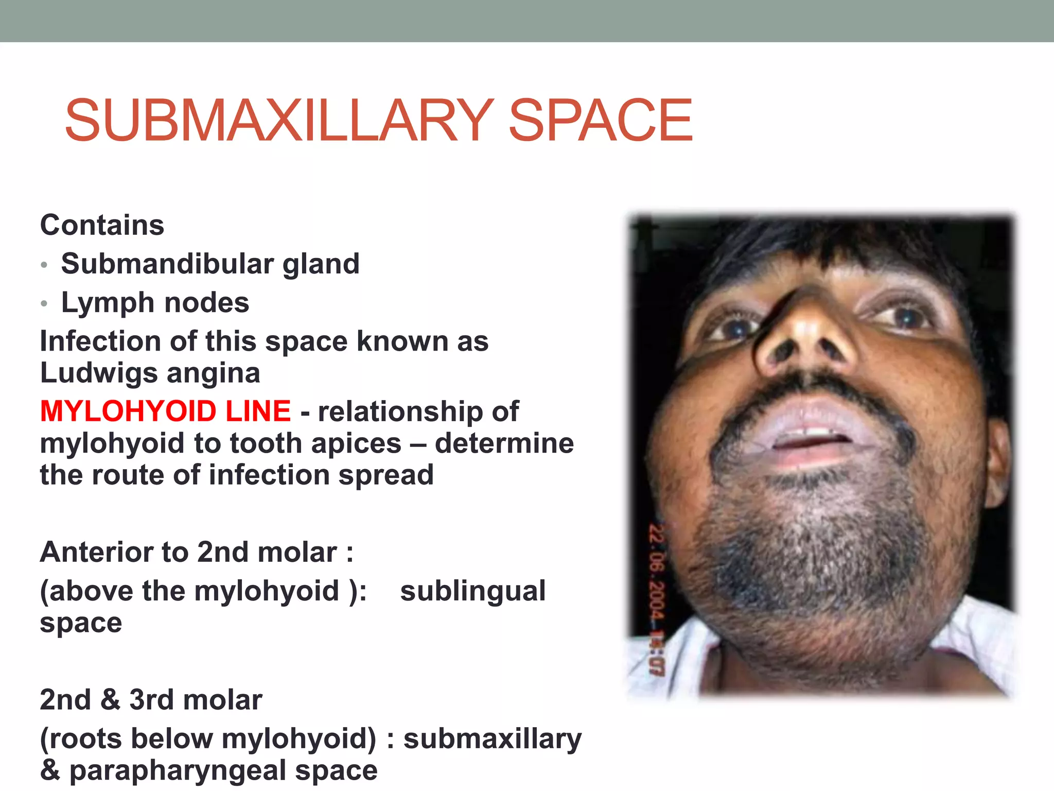 Deep neck spaces and surgical anatomy | PPTX