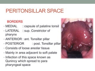 Deep neck spaces and surgical anatomy | PPTX
