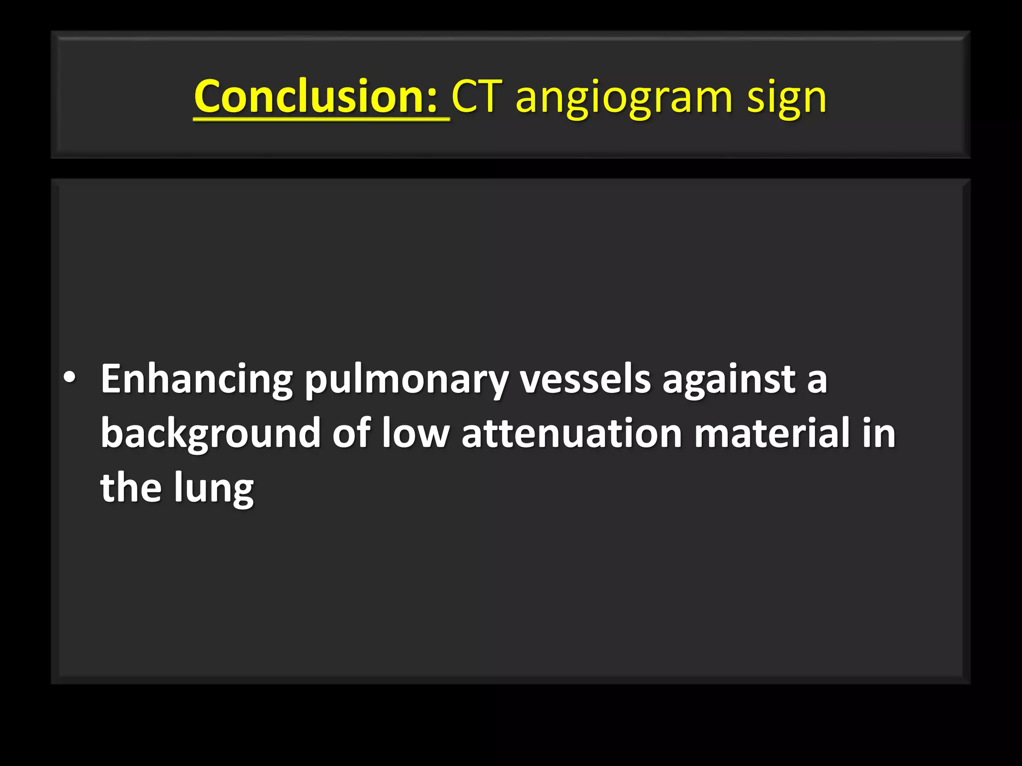 Deep sulcus sign fallen lung sign-ct angiogram sign-flat-waist sign | PPTX