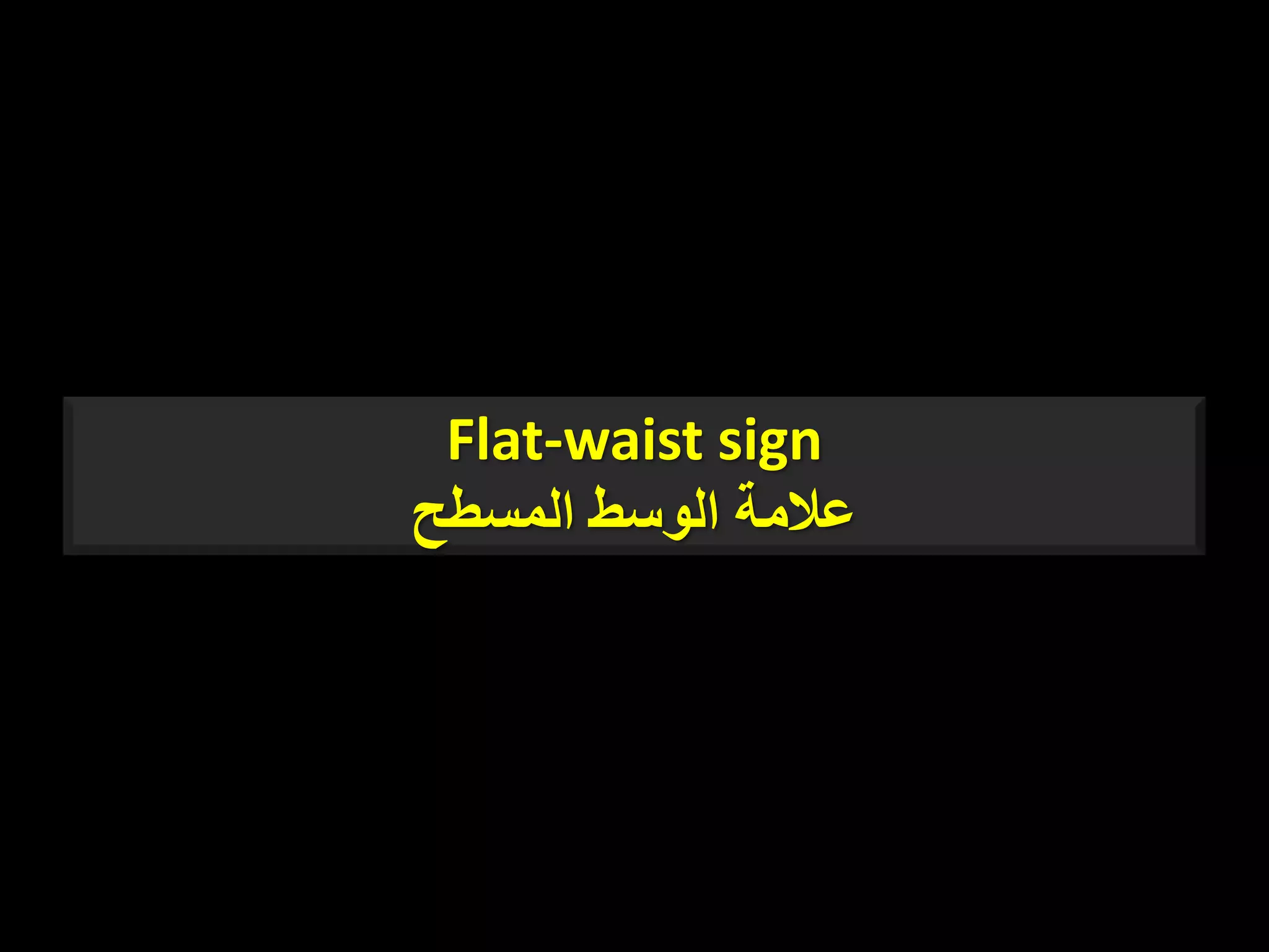 Deep sulcus sign fallen lung sign-ct angiogram sign-flat-waist sign | PPTX