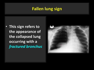 Deep sulcus sign fallen lung sign-ct angiogram sign-flat-waist sign | PPT