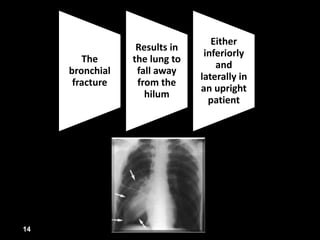 Deep sulcus sign fallen lung sign-ct angiogram sign-flat-waist sign | PPT