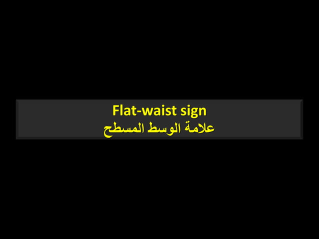 Deep sulcus sign fallen lung sign-ct angiogram sign-flat-waist sign ...