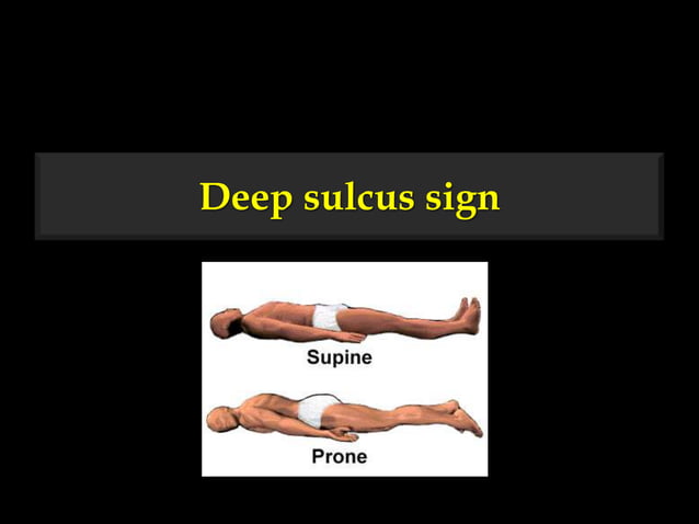 Deep sulcus sign fallen lung sign-ct angiogram sign-flat-waist sign ...