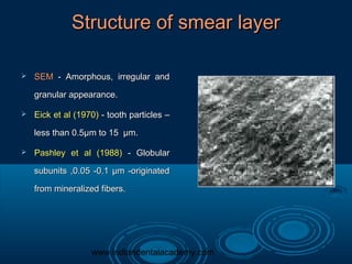 smear layer /certified fixed orthodontic courses by Indian dental ...