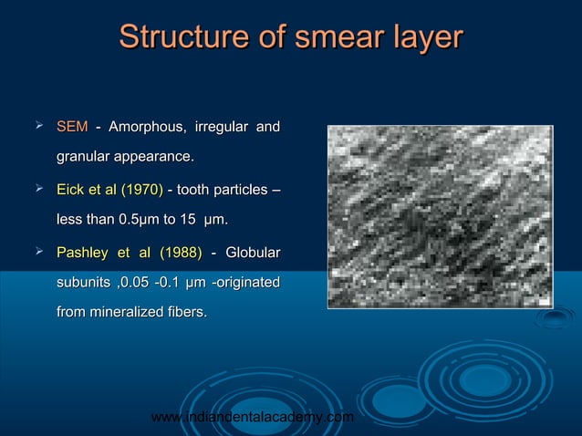 smear layer /certified fixed orthodontic courses by Indian dental academy