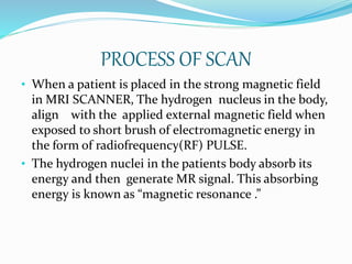 MRI | PPT
