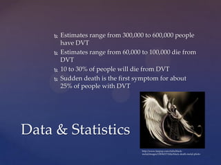 Deep vein thrombosis | PPT