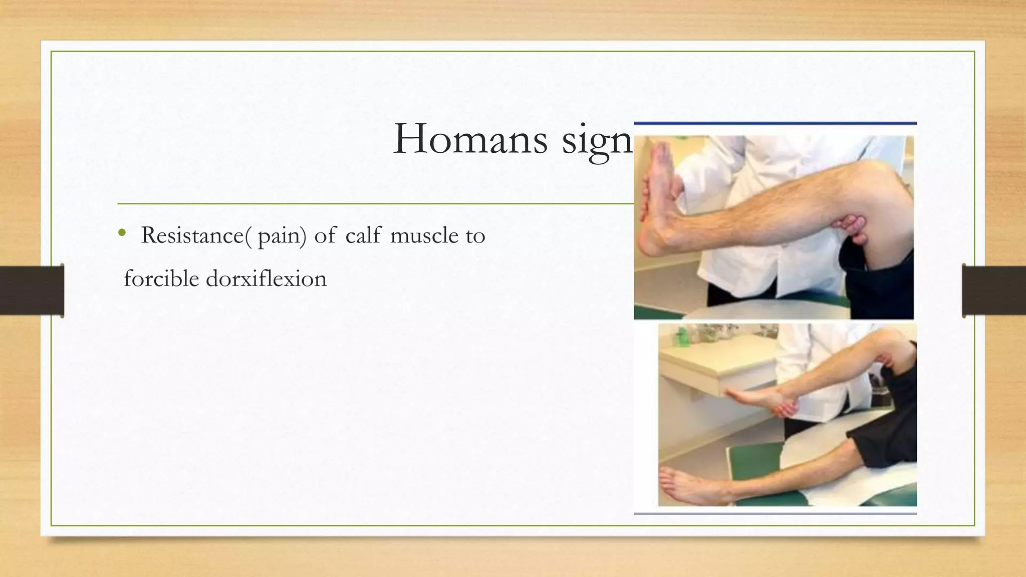 Deep vein thrombosis | PPTX