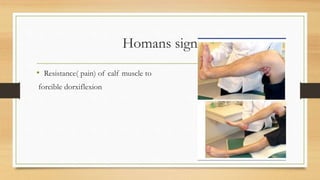 Deep vein thrombosis | PPTX