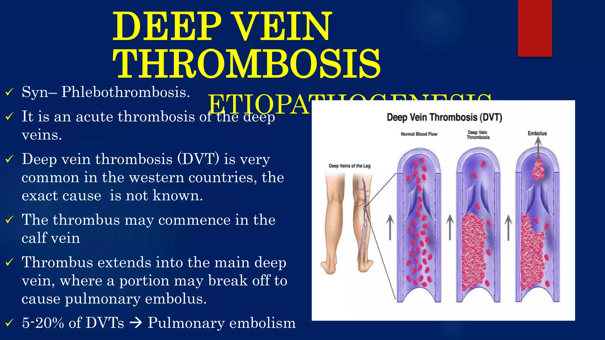 Deep vein thrombosis- Venous diseases | PPTX