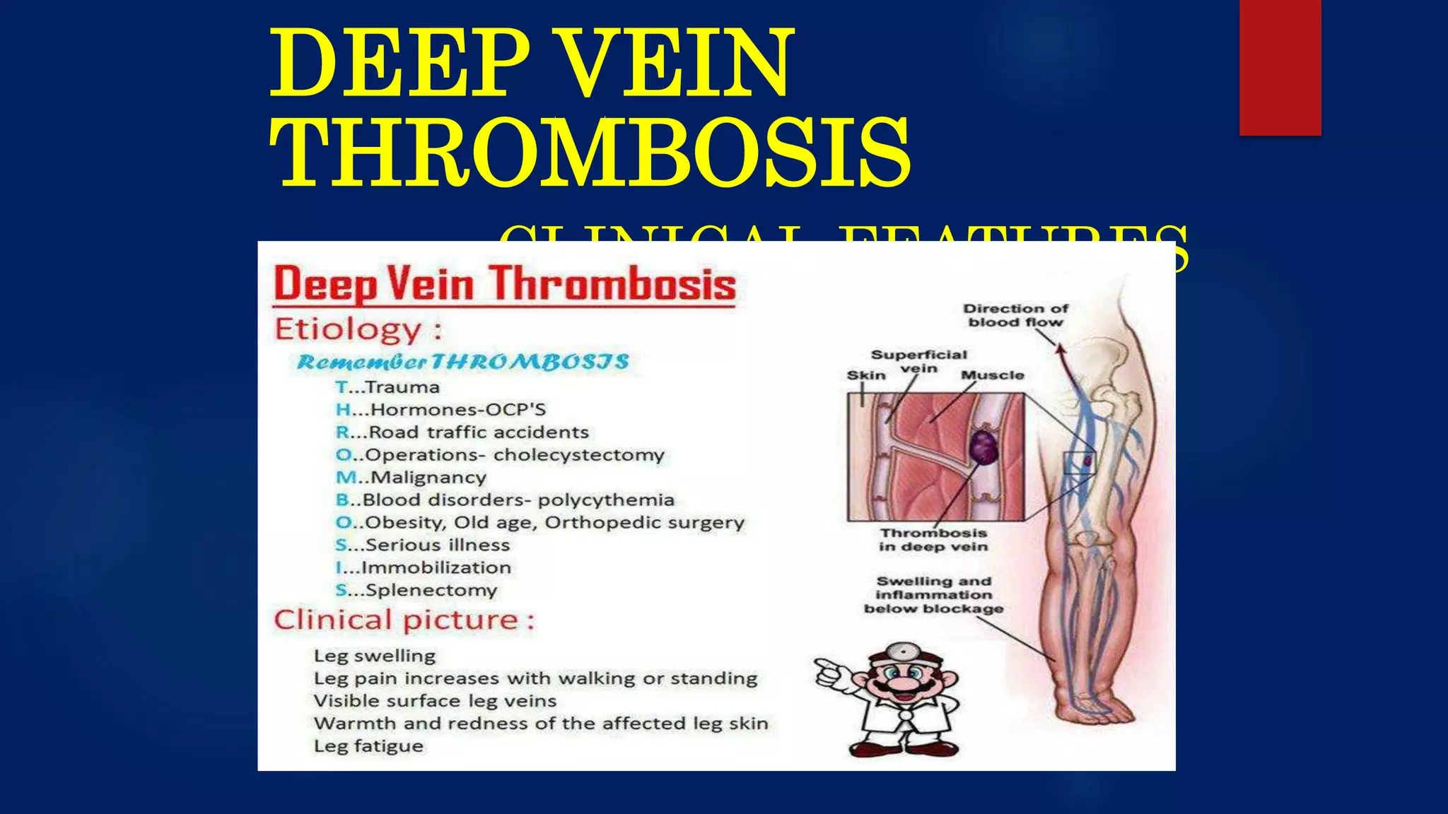 Deep vein thrombosis- Venous diseases | PPTX