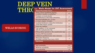 Deep vein thrombosis- Venous diseases | PPTX