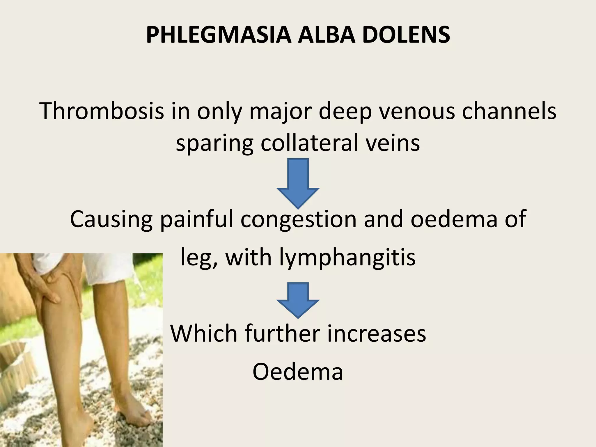 Deep vein thrombosis | PPTX