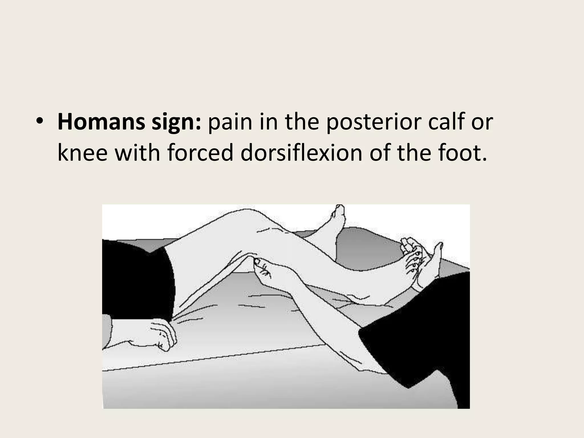 Deep vein thrombosis | PPTX
