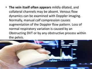 Deep vein thrombosis (DVT) | PPTX