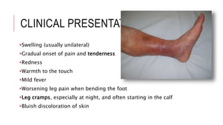Deep Vein Thrombosis | PPTX