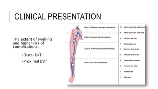 Deep Vein Thrombosis | PPT