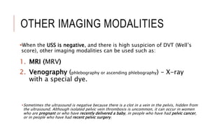 Deep Vein Thrombosis | PPT