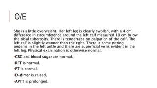 Deep Vein Thrombosis | PPTX
