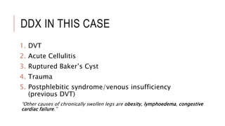 Deep Vein Thrombosis | PPT
