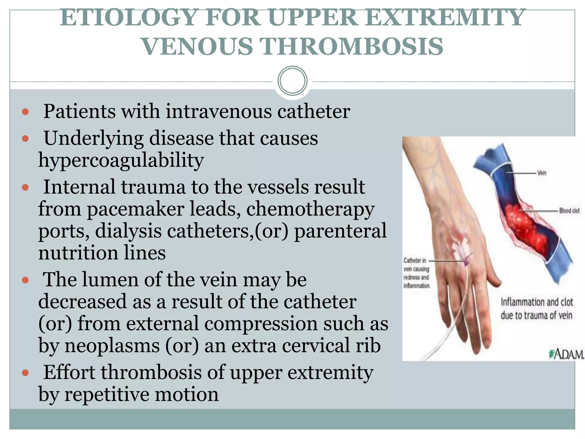 DVT (Deep vein thrombosis) | PDF
