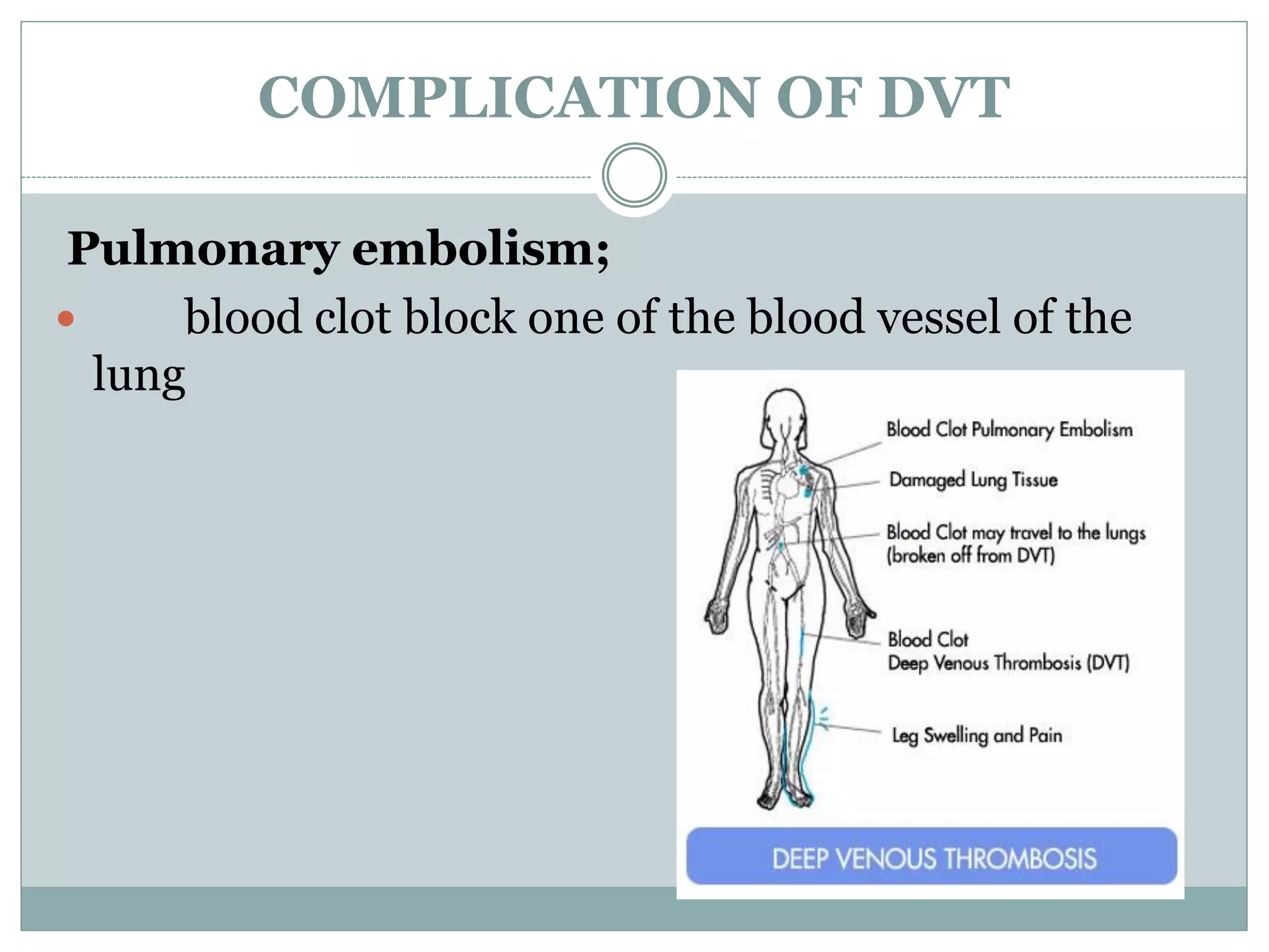 DVT (Deep vein thrombosis) | PDF