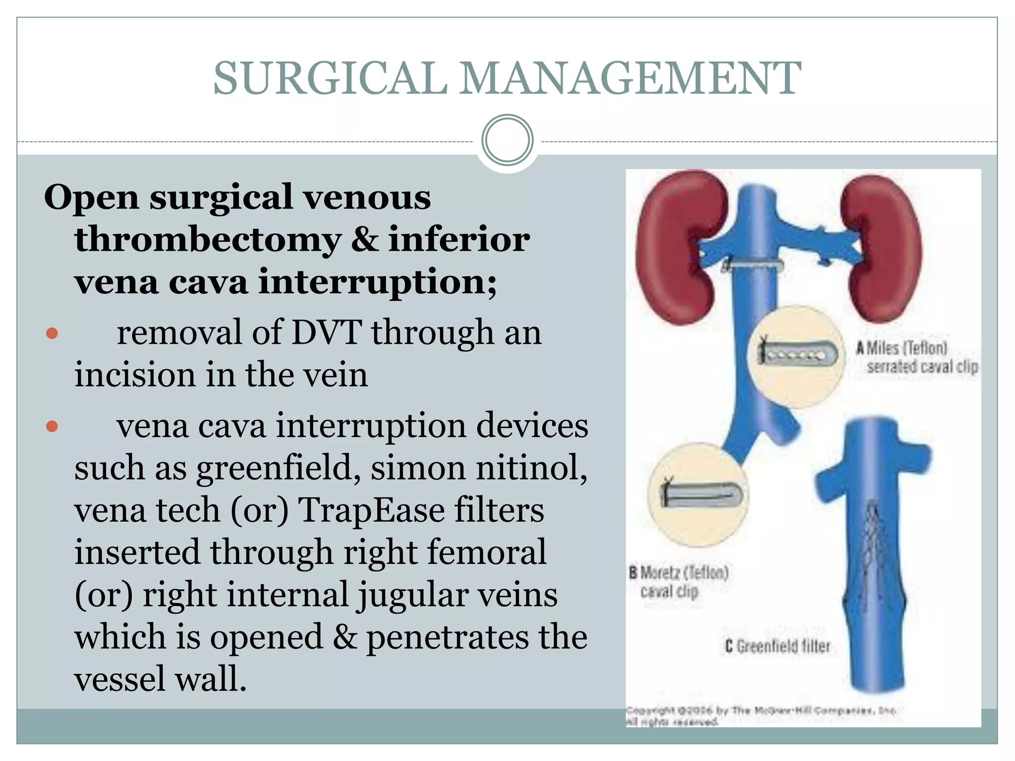DVT (Deep vein thrombosis) | PDF