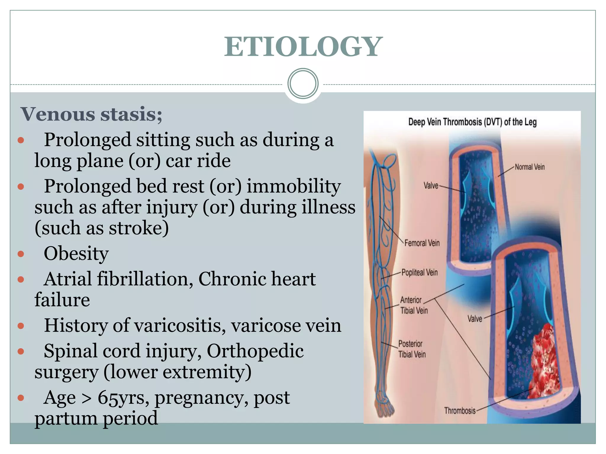 DVT (Deep vein thrombosis) | PDF