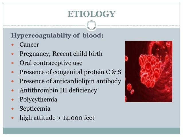 DVT (Deep vein thrombosis) | PDF