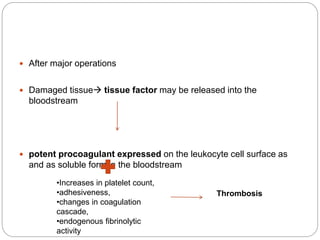 Deep vein thrombosis | PPTX