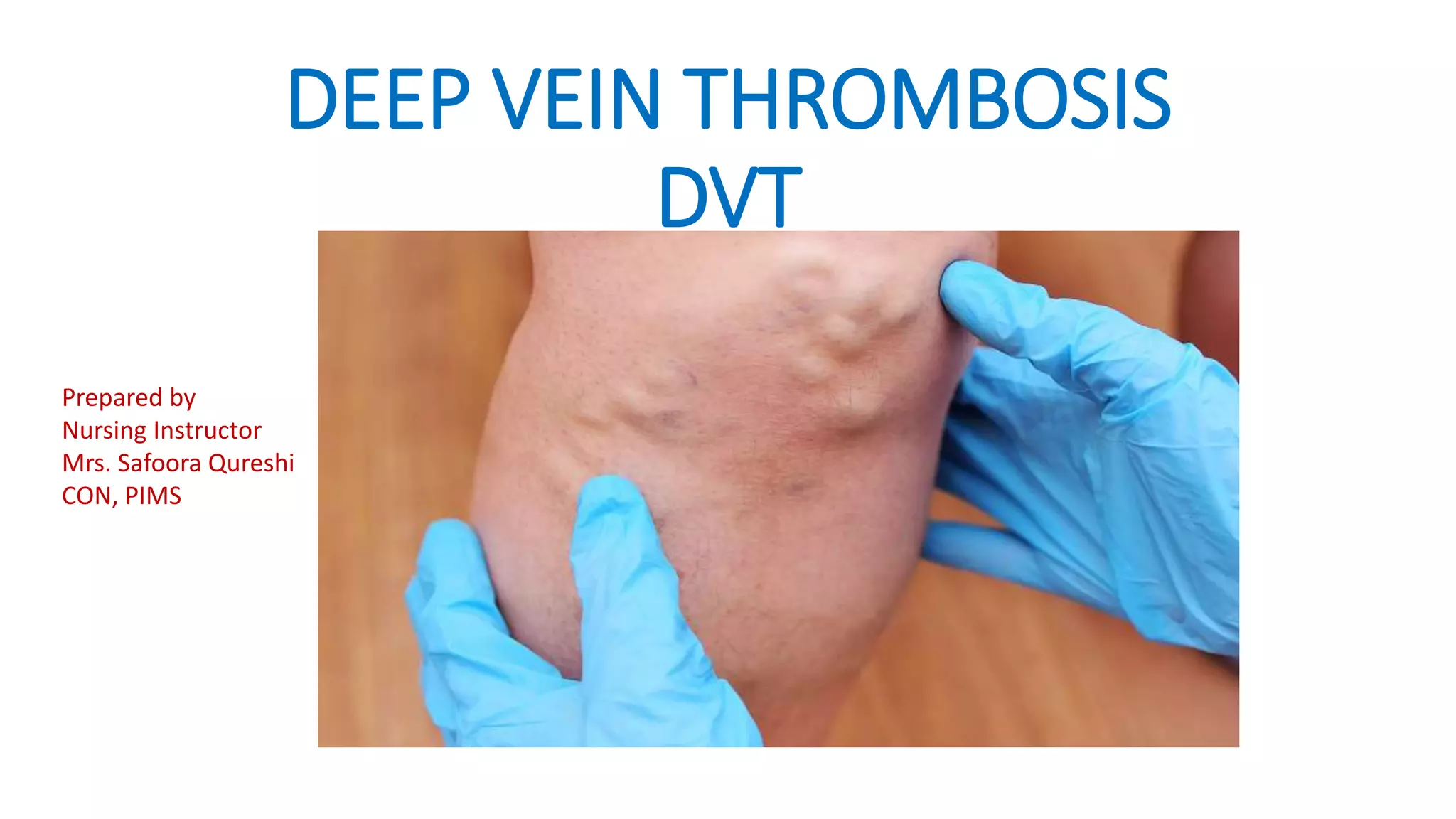DEEP VEIN THROMBOSIS - Copy.pptx