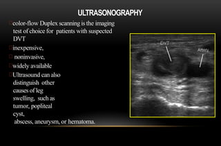 Deep vein thrombosis Ultrasound | PPTX