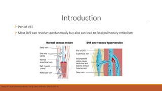 Deep Vein Thrombosis | PPT