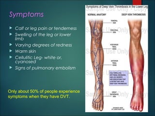 Deep vein thrombosis | PPT