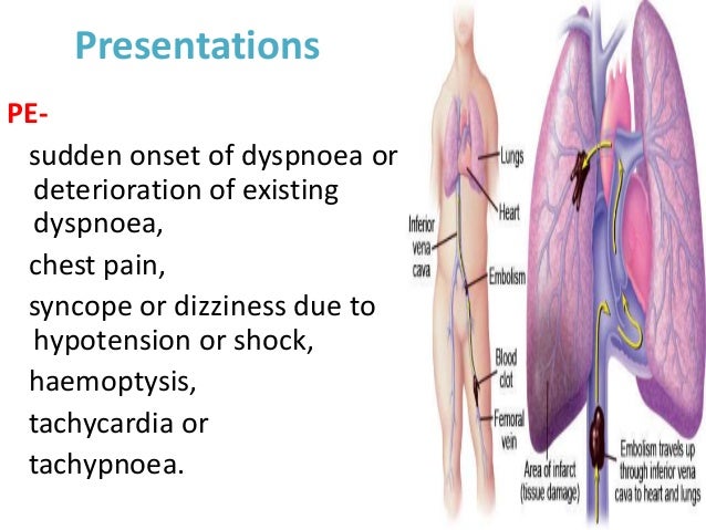 Deep vein thrombosis (DVT) and Pulmonary embolism (PE)