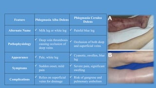 Deep Vein Thrombosis(DVT) BY DR SAMI KUMAR SHAH.pptx